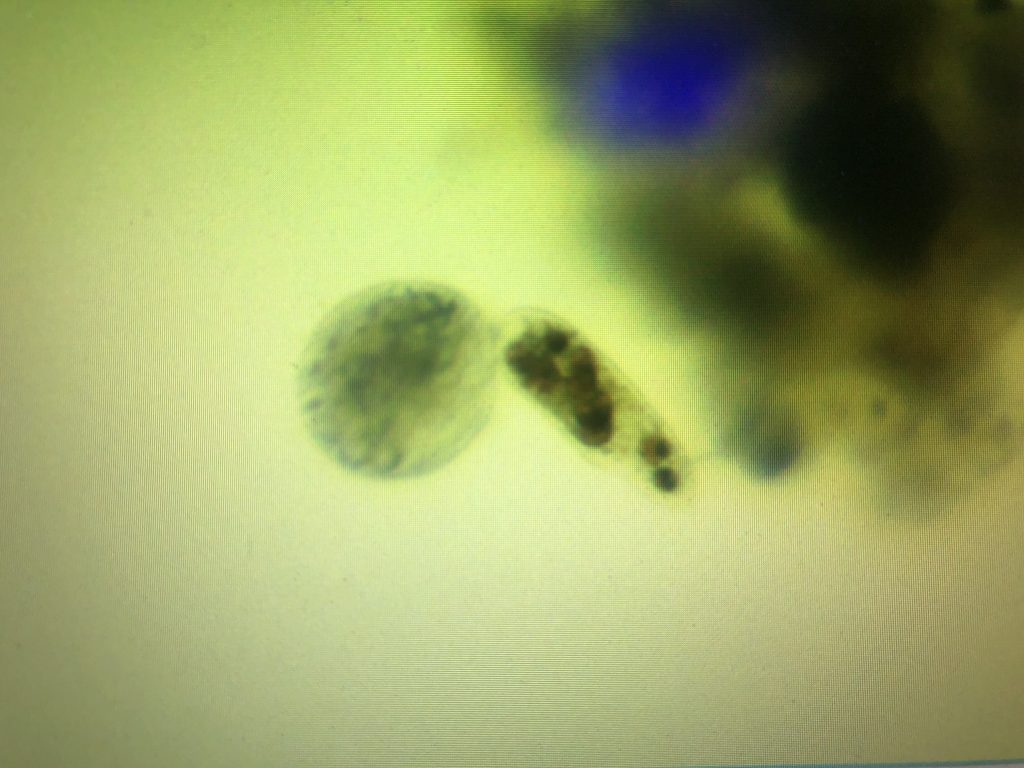 Microscopic Diagnosis - Coral RTN