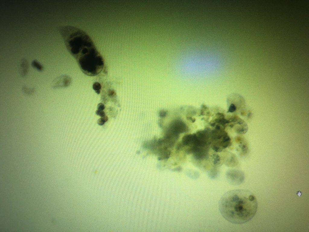 Microscopic Diagnosis - Coral RTN